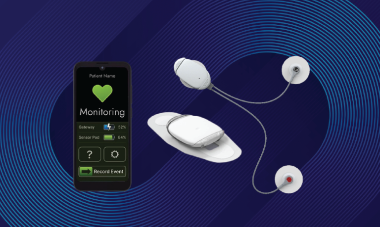 InfoBionic.Ai | The MoMe ARC® : InfoBionic.Ai's MoMe ARC®: Enabling the ...